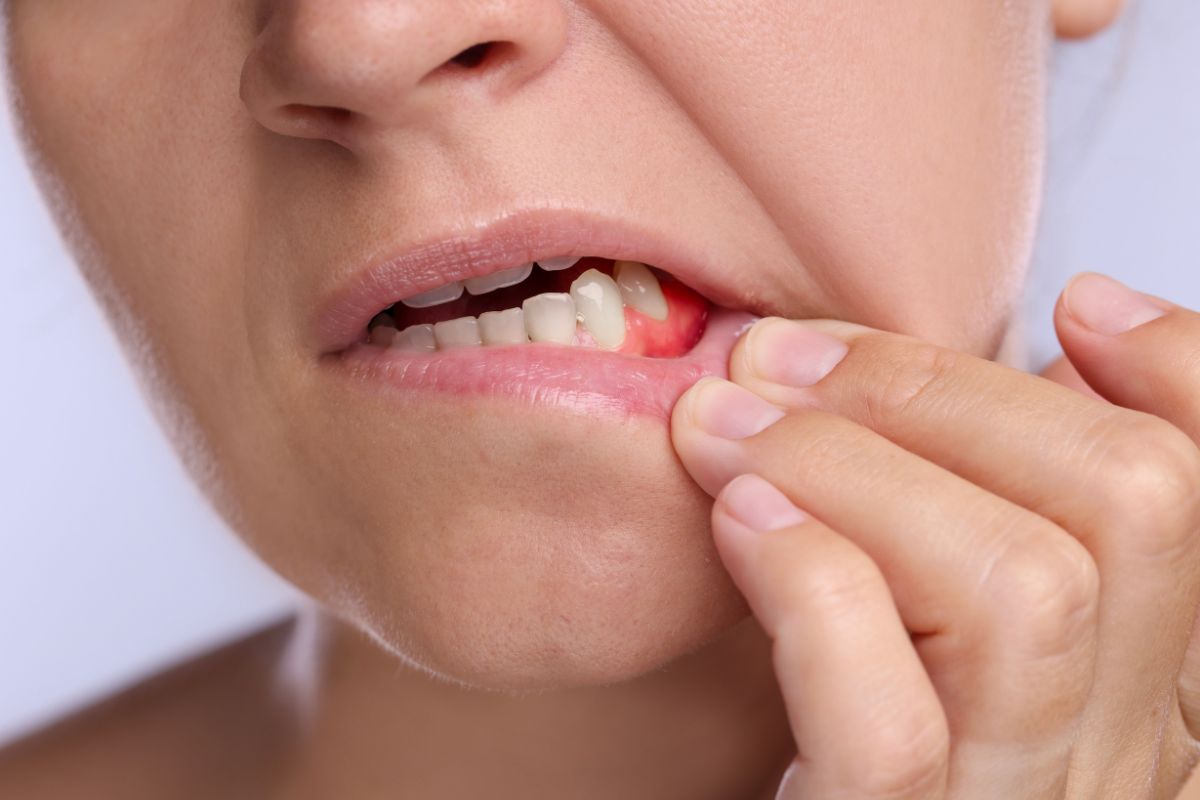 What Causes Throbbing Tooth Pain?